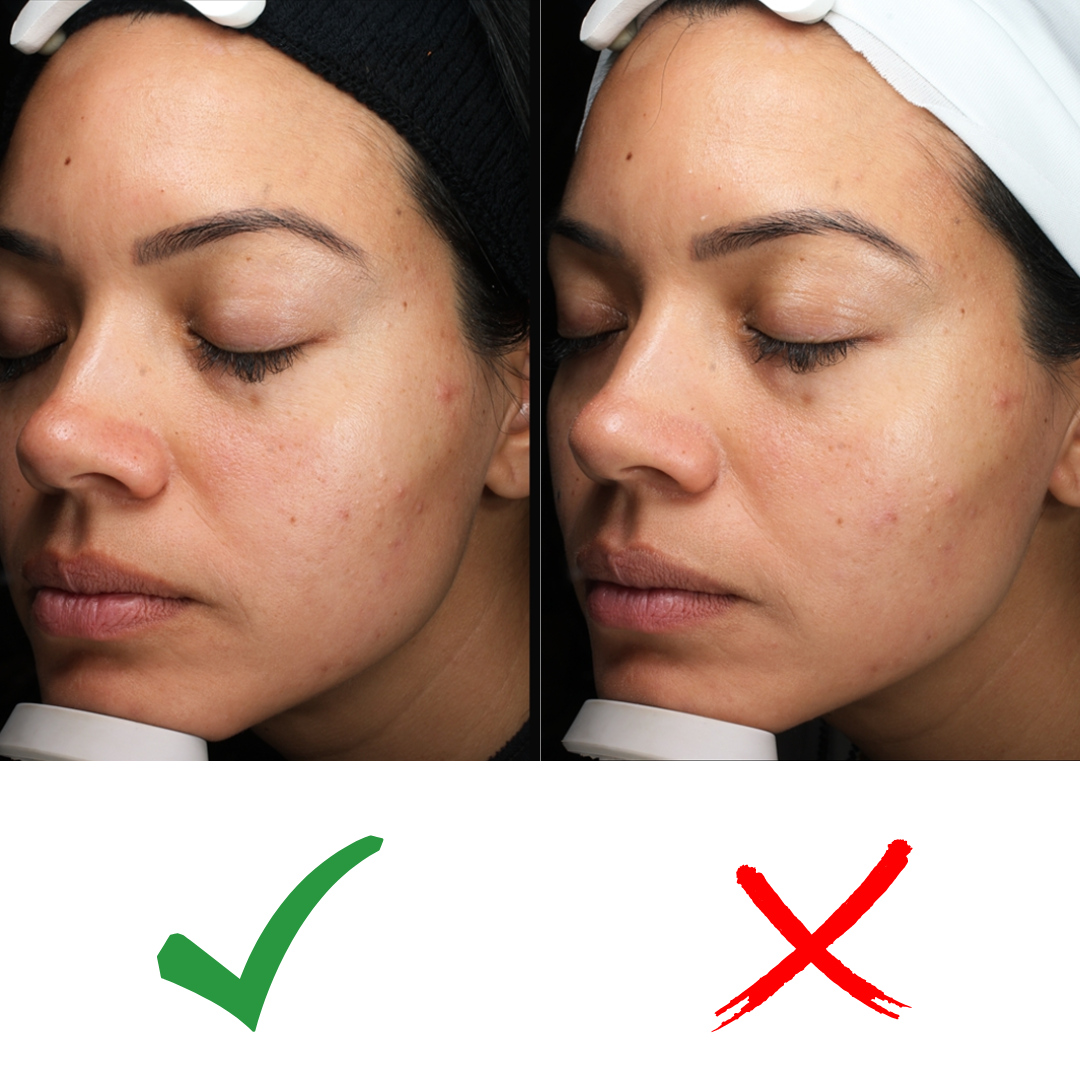 How To Best Prepare Your Clients For Visia Captures | Canfield Scientific