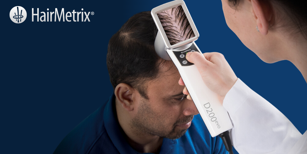Hairmetrix Vs. Traditional Methods Redefining Hair Consultations With ...
