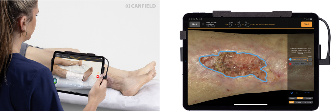 Canfield Scientifics Clinical Imaging Services Support Birchbiomed Inc ...