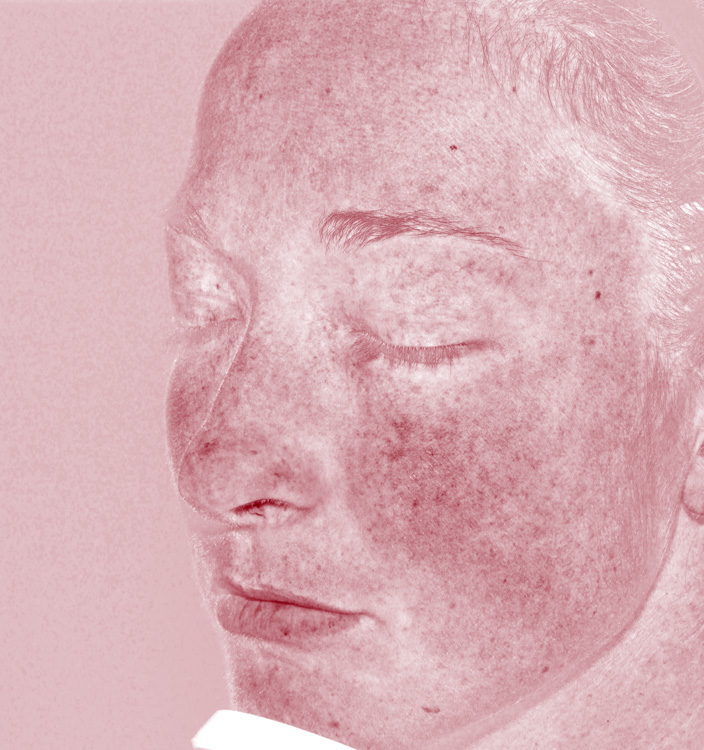 Reveal Imager | Canfield Scientific